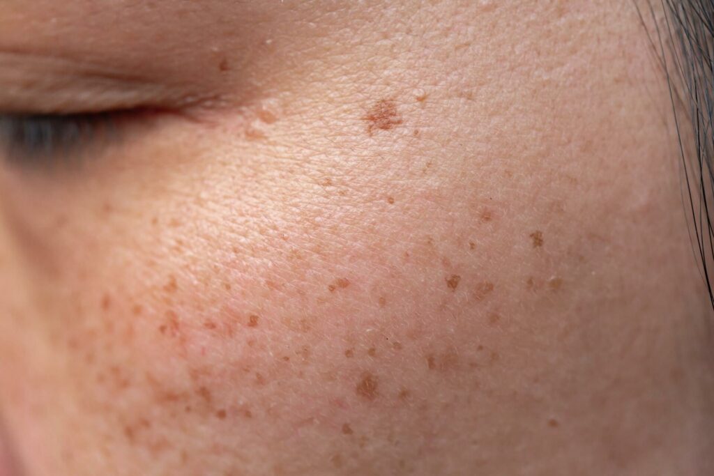 Dermatologist | Golden State Dermatology