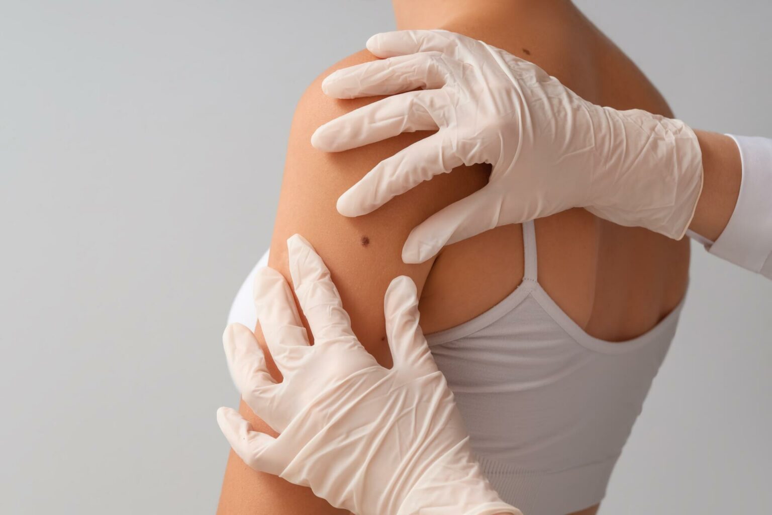 What Does Skin Cancer Look Like Under a Microscope? - Golden State ...