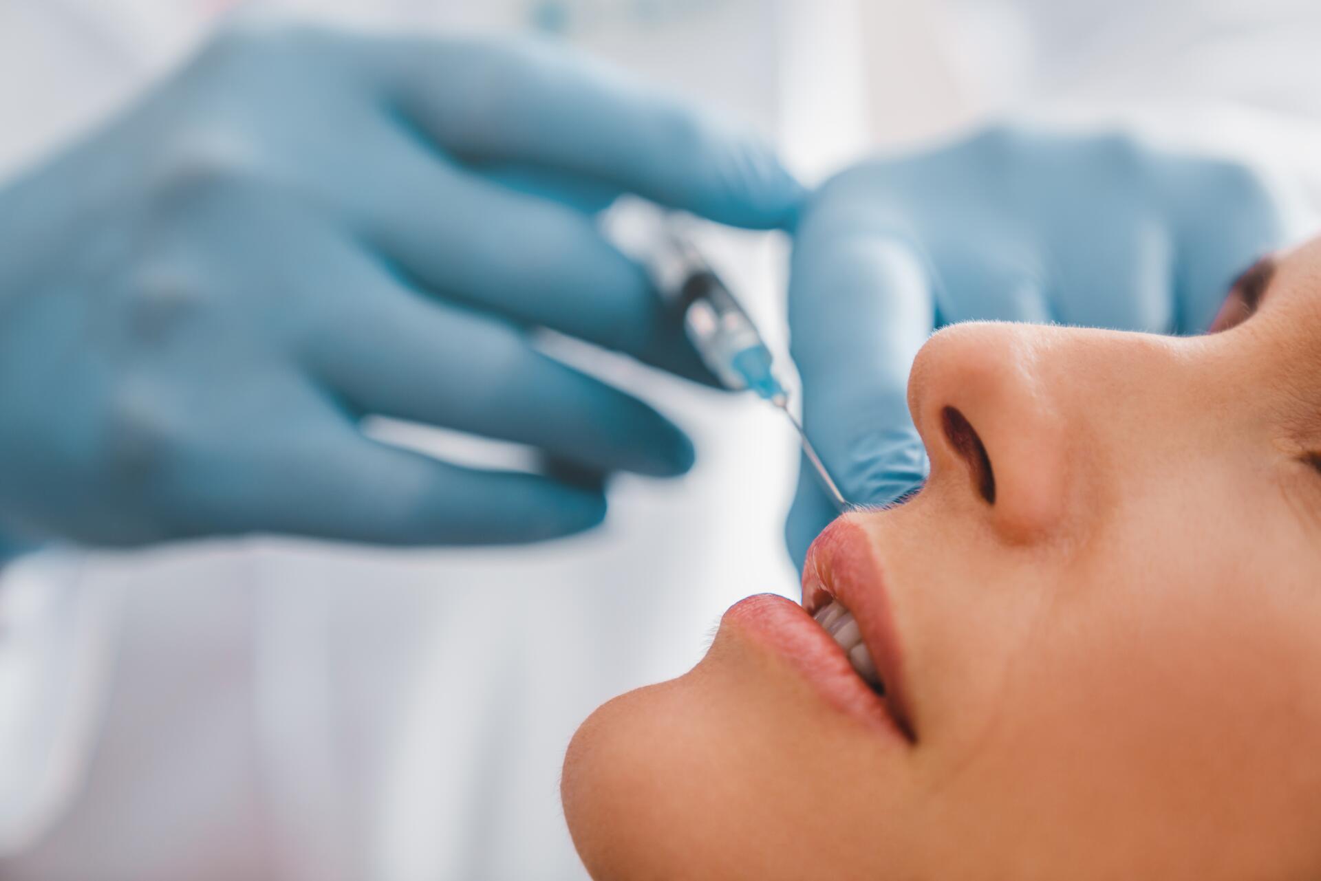 Who Should Try a Botox Lip Flip? - Golden State Dermatology