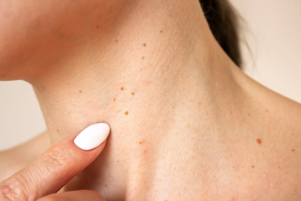The Removal Guide: How to Get Glue, Dye, and Marker Off Your Skin ...